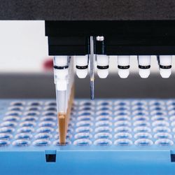 Webinar: Insights on Automated Liquid Handling Systems | Lab Manager