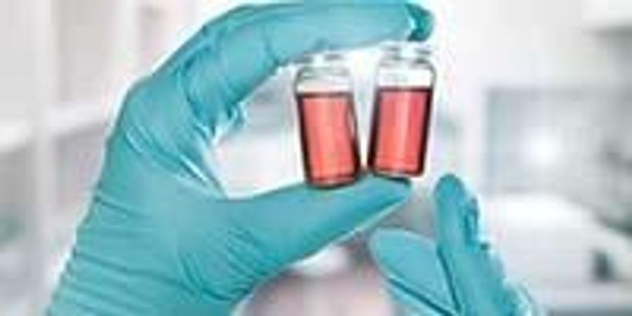 Choosing a Smarter Automated System for Sample Management | Lab Manager