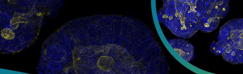 Understanding Organoid Morphology | Lab Manager