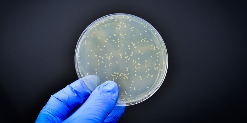 Plastic-Eating Bacteria Turn Waste into Useful Starting Materials | Lab ...