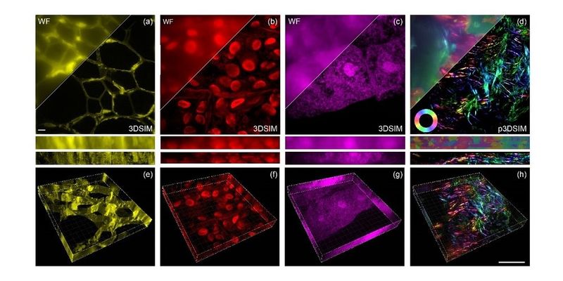 Super-Resolution Microscopy Harnesses Digital Display Technology | Lab ...