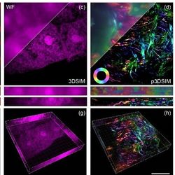 AI in Microscopy | Lab Manager