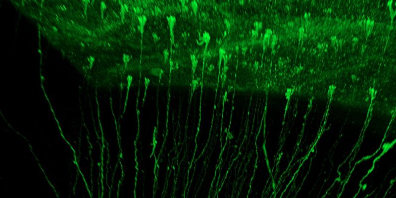 Study Uncovers Multiple Lineages of Stem Cells Contributing to Neuron ...
