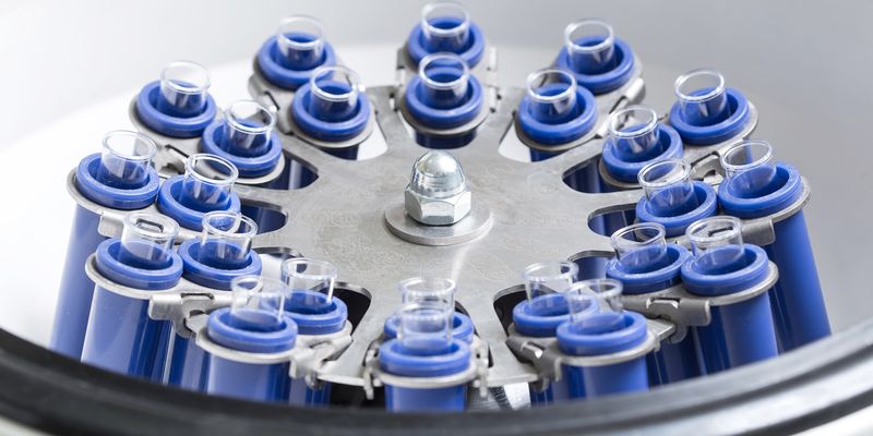 Best Practices in Ultracentrifugation | Lab Manager