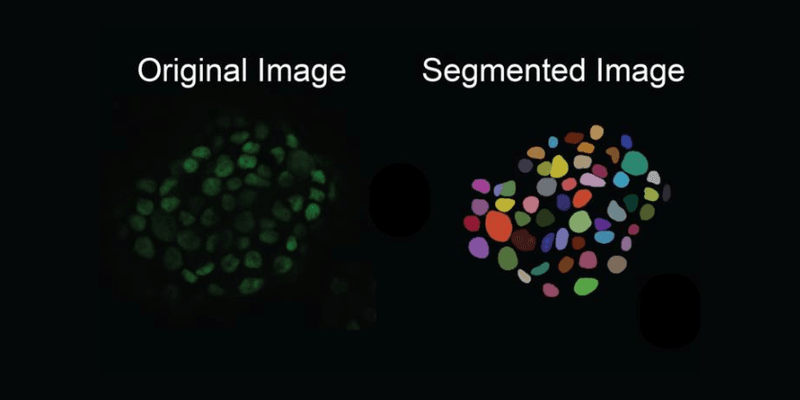 AI Tool Creates ‘Synthetic’ Images of Cells for Enhanced Microscopy ...