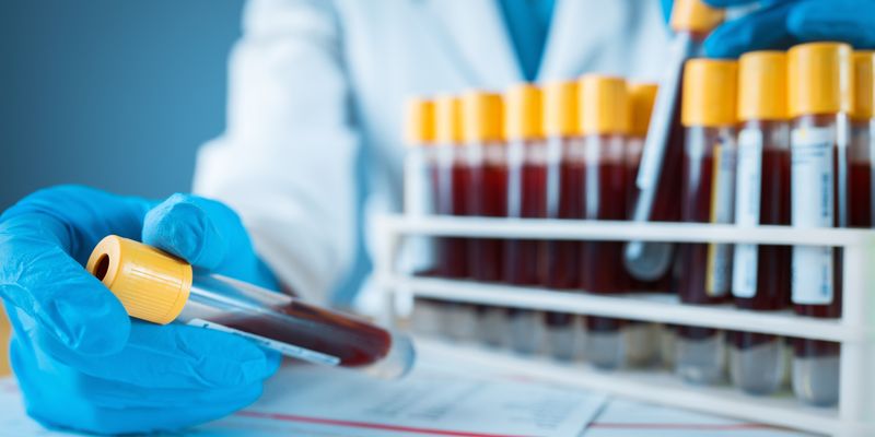One Drop of Blood, Many Diagnoses: Infrared Spectroscopy for Screening ...