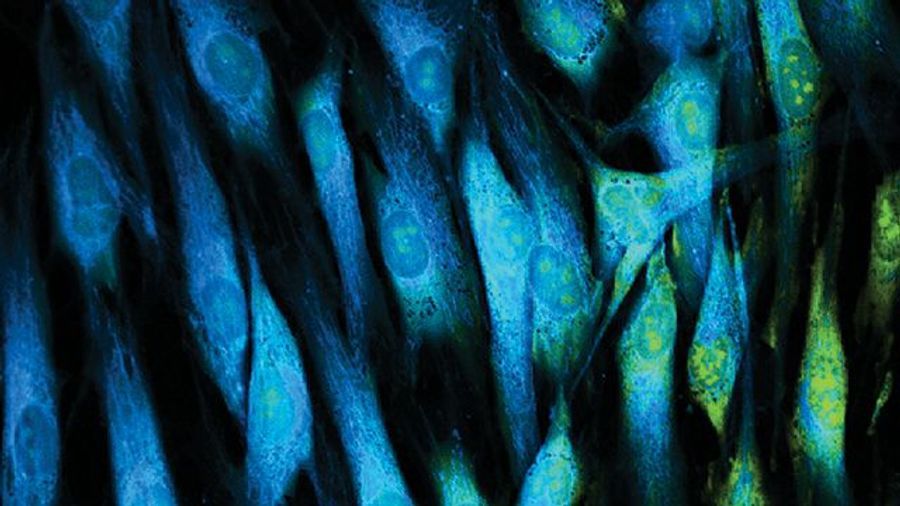 The Latest in Live Cell Imaging | Lab Manager