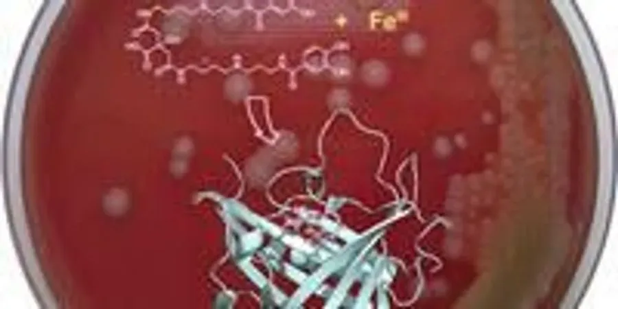 #Anthrax | Lab Manager