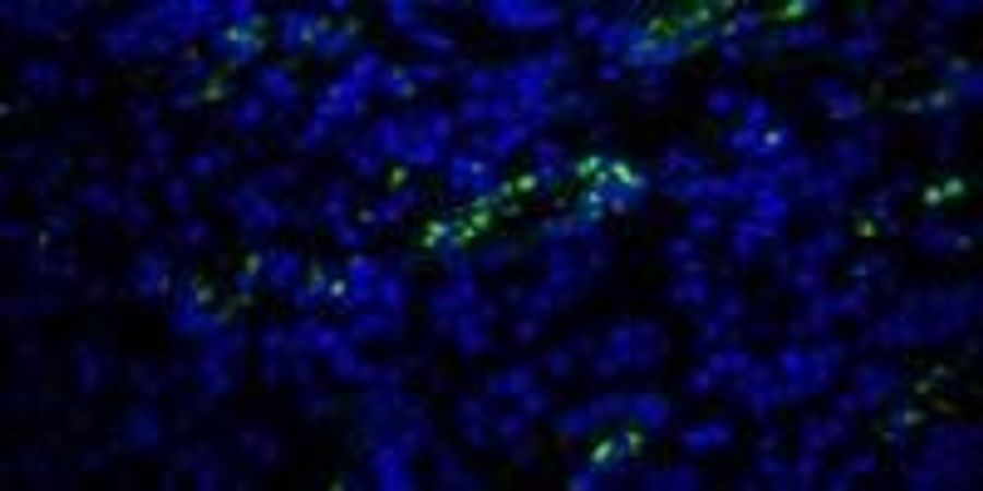 Viruses Under the Microscope | Lab Manager