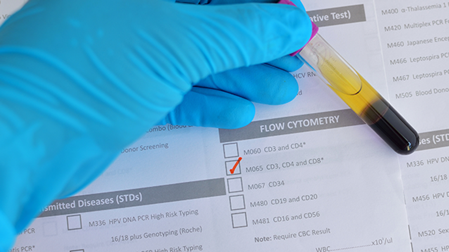 Fluorescence Activated Cell Sorting For Cell Based Therapies Lab Manager