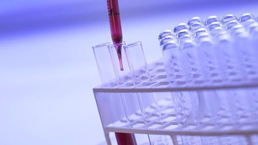 How Clinical Labs Can Adapt to Reimbursement Cuts | Lab Manager