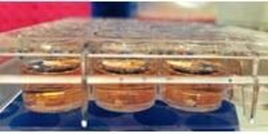 A New Milestone in Laboratory Grown Human Brain Tissue | Lab Manager