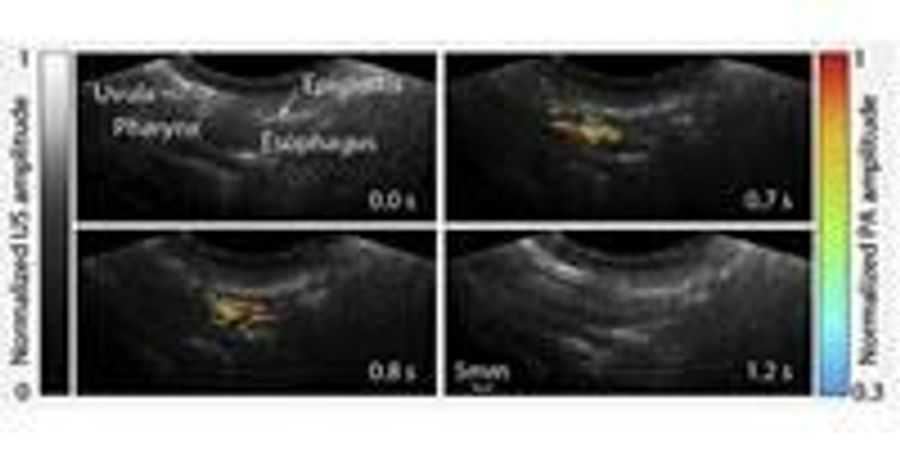 Beer. Soup. Barley's Next Great Use? A Medical Imaging Drink | Lab Manager