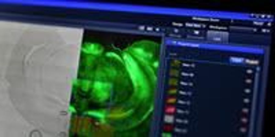 ZEISS Presents New Enhanced Software Technology | Lab Manager