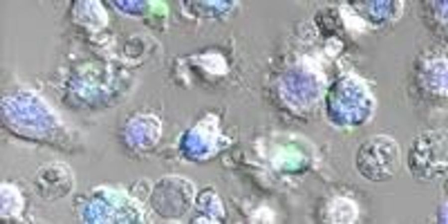 A New Kind of Vaccine Based on Spider Silk | Lab Manager