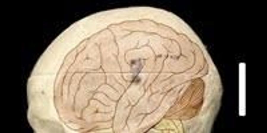 Meet NOTCH2NL, the Human-Specific Genes That May Have Given Us Our Big ...