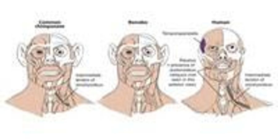 'Uniquely Human' Muscles Have Been Discovered in Apes | Lab Manager