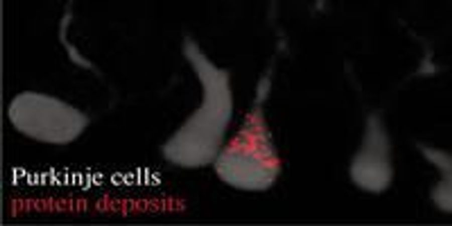 Researchers Identify Gene That Helps Prevent Brain Disease | Lab Manager