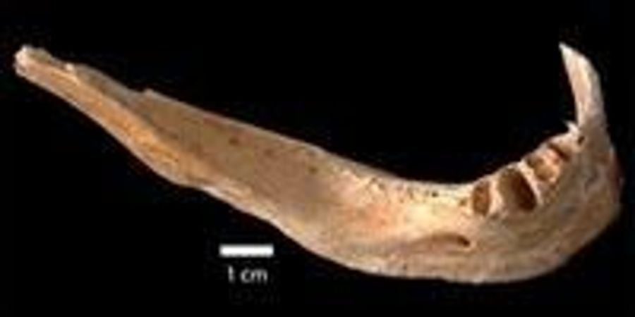 Scientists Calculate Radiation Dose in Bone from Victim of Hiroshima ...