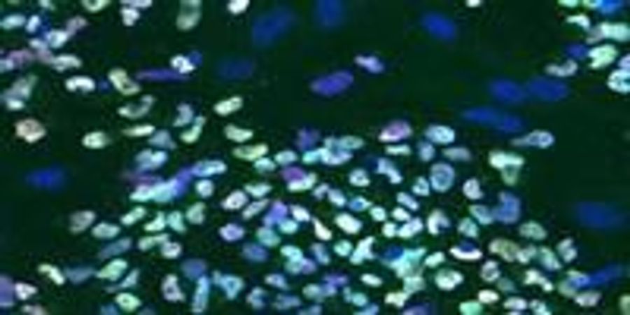 UCLA Research May Explain Some Causes of Infertility and Miscarriage ...