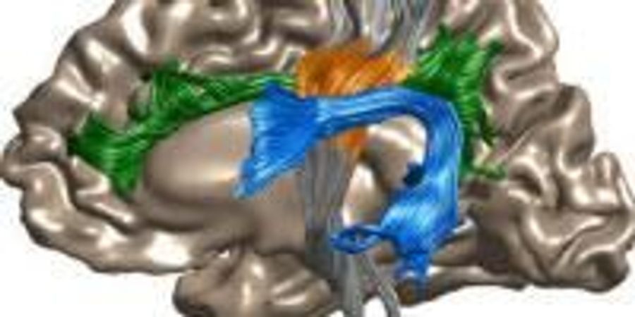 Democratizing Science: Researchers Make Neuroscience Experiments Easier ...