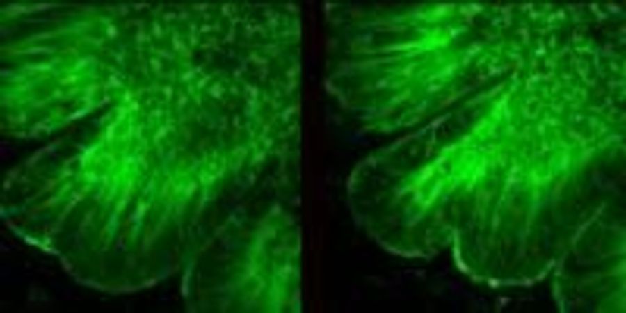 “Brain on a Chip” Reveals How the Brain Folds | Lab Manager