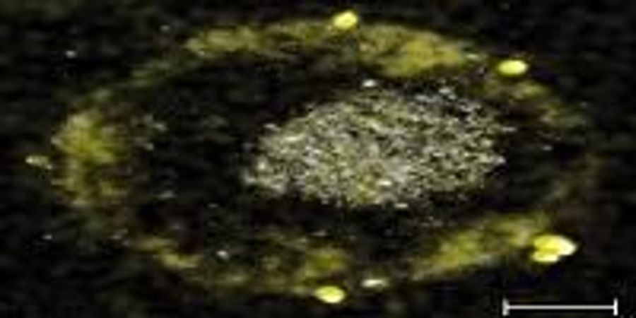These Bacteria Produce Gold by Digesting Toxic Metals | Lab Manager