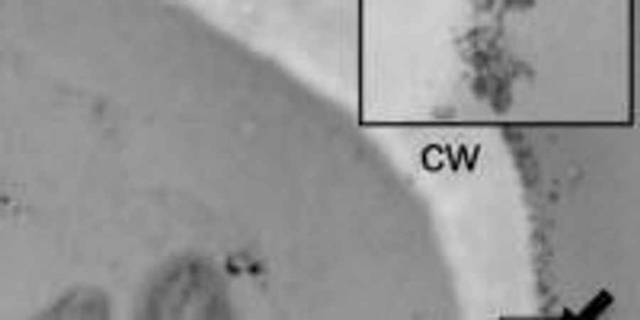 Clean and Green: A Moss That Removes Lead from Water | Lab Manager