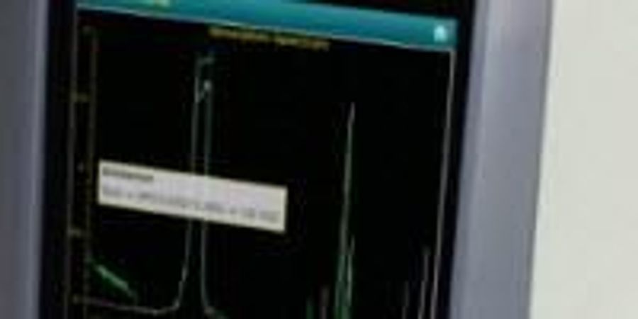 MINISCAN IR Vision: Top Performer in Portable Fuel Analysis | Lab Manager