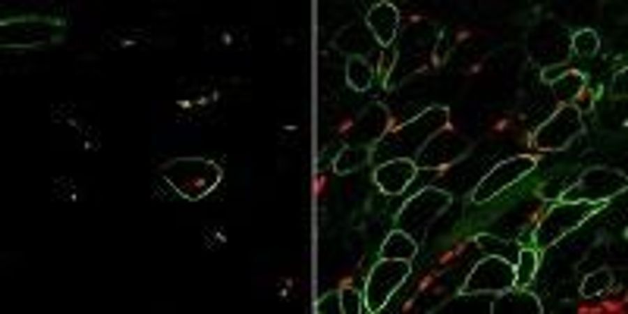 UCLA Researchers Create Skeletal Muscle From Stem Cells | Lab Manager