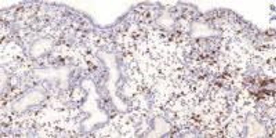 Womb Natural Killer Cell Discovery Could Lead to Screening for ...