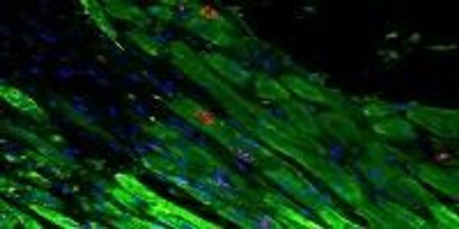 Injectable Gel That Helps Heart Muscle Regenerate After Heart Attack ...