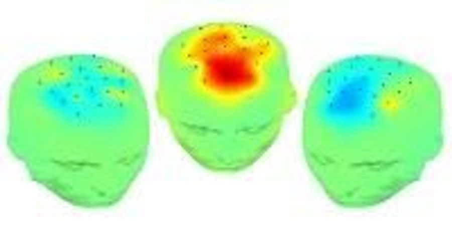 Low Frequency Brain Stimulation Improves Cognition in Parkinson's ...