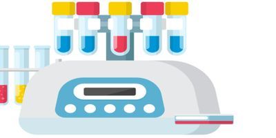 The Laboratory Ultrafiltration Guide | Lab Manager