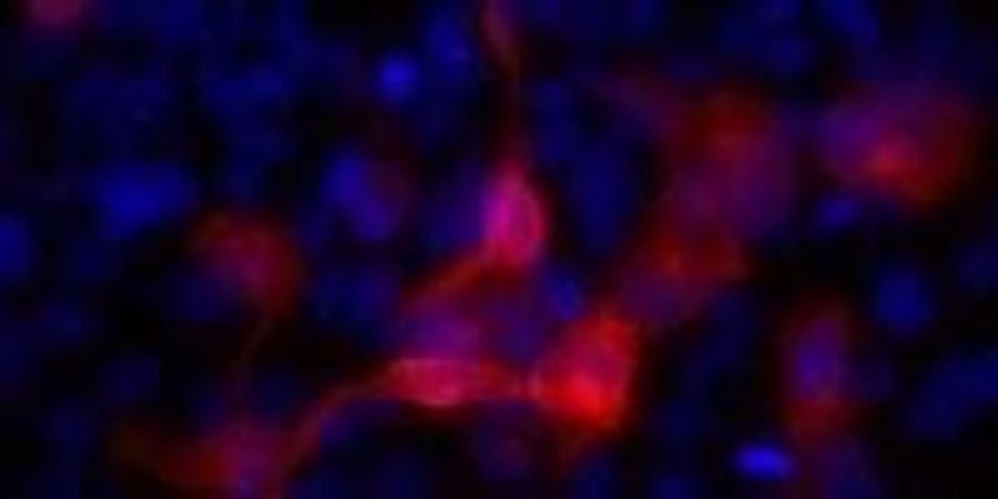 Horizon Discovery's Dharmacon Introduces Edit-R CRISPRa Reagent ...