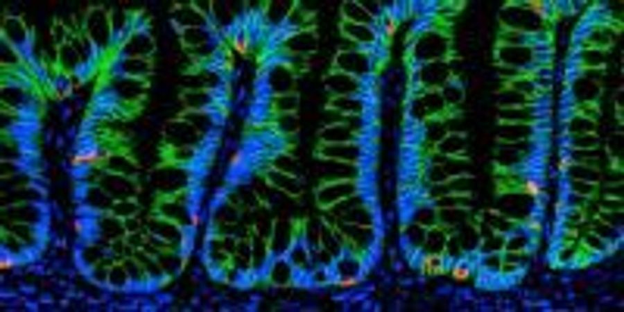 Synthetic Hydrogels Deliver Cells to Repair Intestinal Injuries | Lab ...