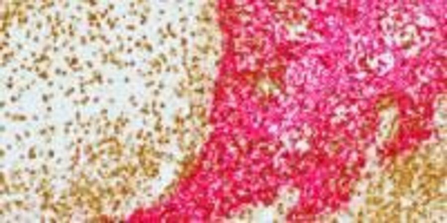 New Polymer Kit Enables IHC Staining of Two Target Antigens in One ...