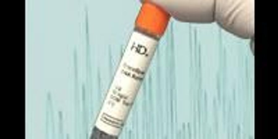 Horizon Discovery Introduces OncoSpan, the World's Largest DNA ...