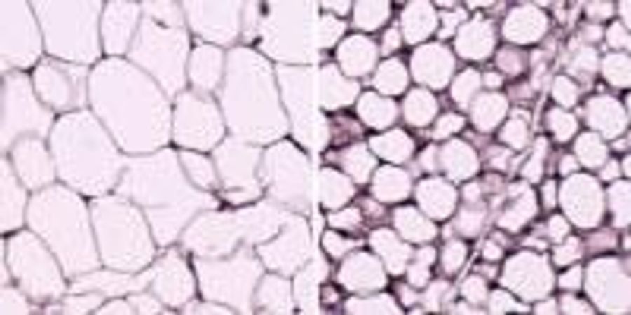 Scientists Find Way to Convert Bad Body Fat into Good Fat | Lab Manager