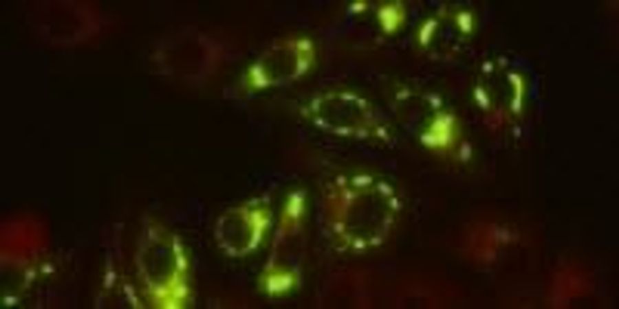 New Yellow Fever Virus Monoclonal Antibodies | Lab Manager