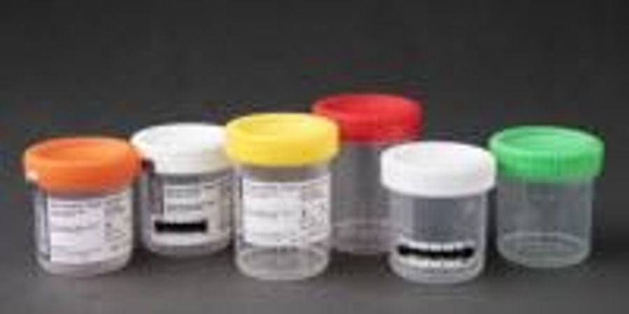New Thermo Scientific Samco Leakproof Vials Offer Enhanced Sample and ...