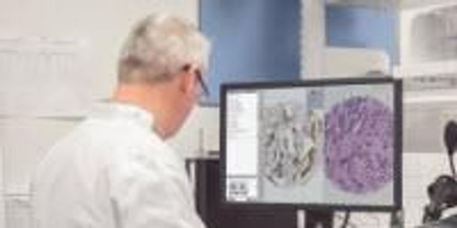 Philips Speeds up Research and Biomarker Discovery with Major Upgrade ...