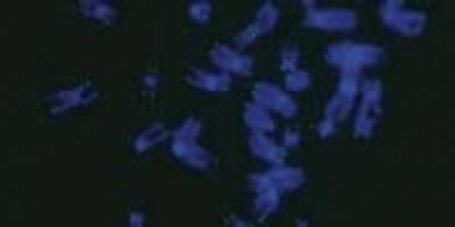 CRISPR Sheds Light on Rare Pediatric Bone Marrow Failure Syndrome | Lab ...