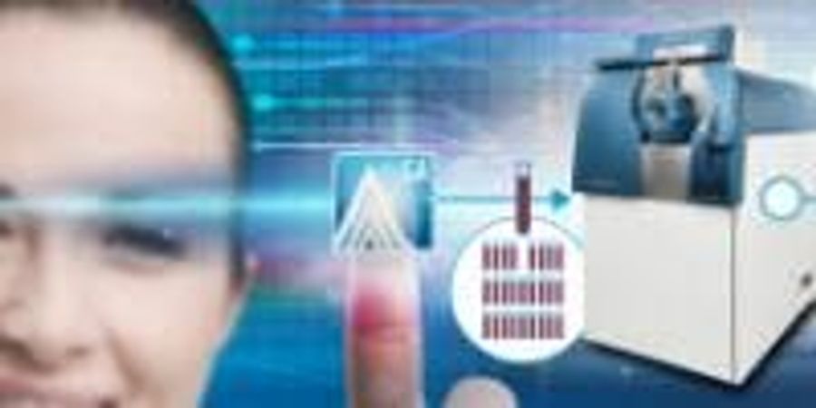 SCIEX Launches Its SWATH Data Independent Acquisition Technology for ...
