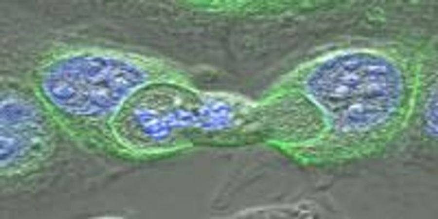 Cannibal Cells May Limit Cancer Growth | Lab Manager