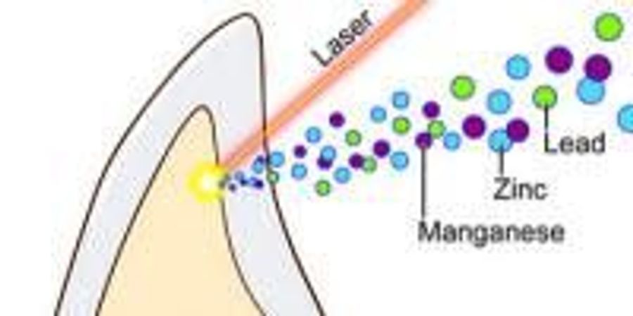 Baby Teeth Link Autism and Heavy Metals, NIH Study Suggests | Lab Manager