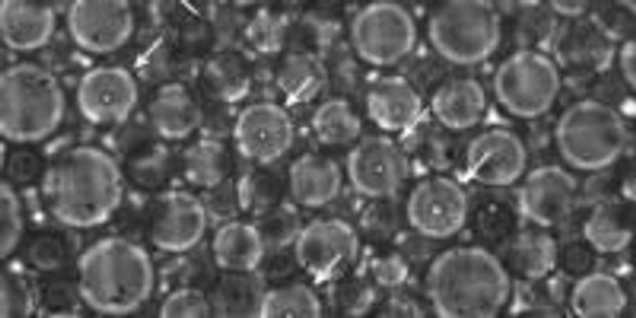 Researchers Apply New Immune Technologies in Search of Mono Vaccine ...