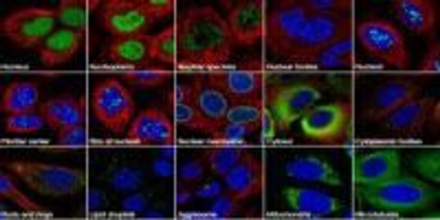 First Comprehensive Map of Subcellular Localization of Proteins Reveals ...