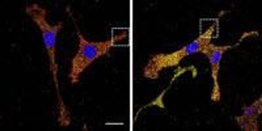 Imaging mRNA Right Where It Is Made—at the Site of Translation | Lab ...