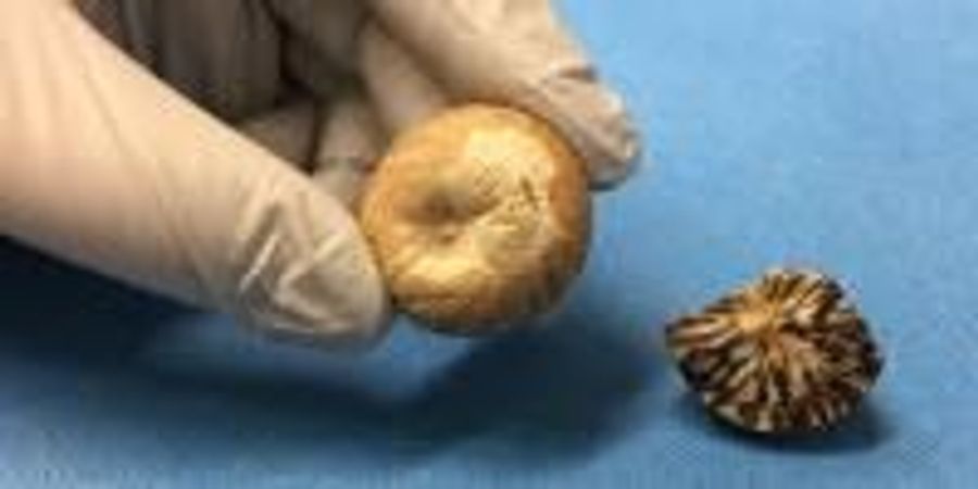 Addictive Nut's Derivatives Could Help Smokers Break the Nicotine Habit ...